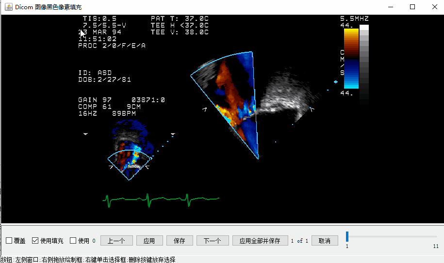 介绍几款DICOM匿名化工具 - 知乎