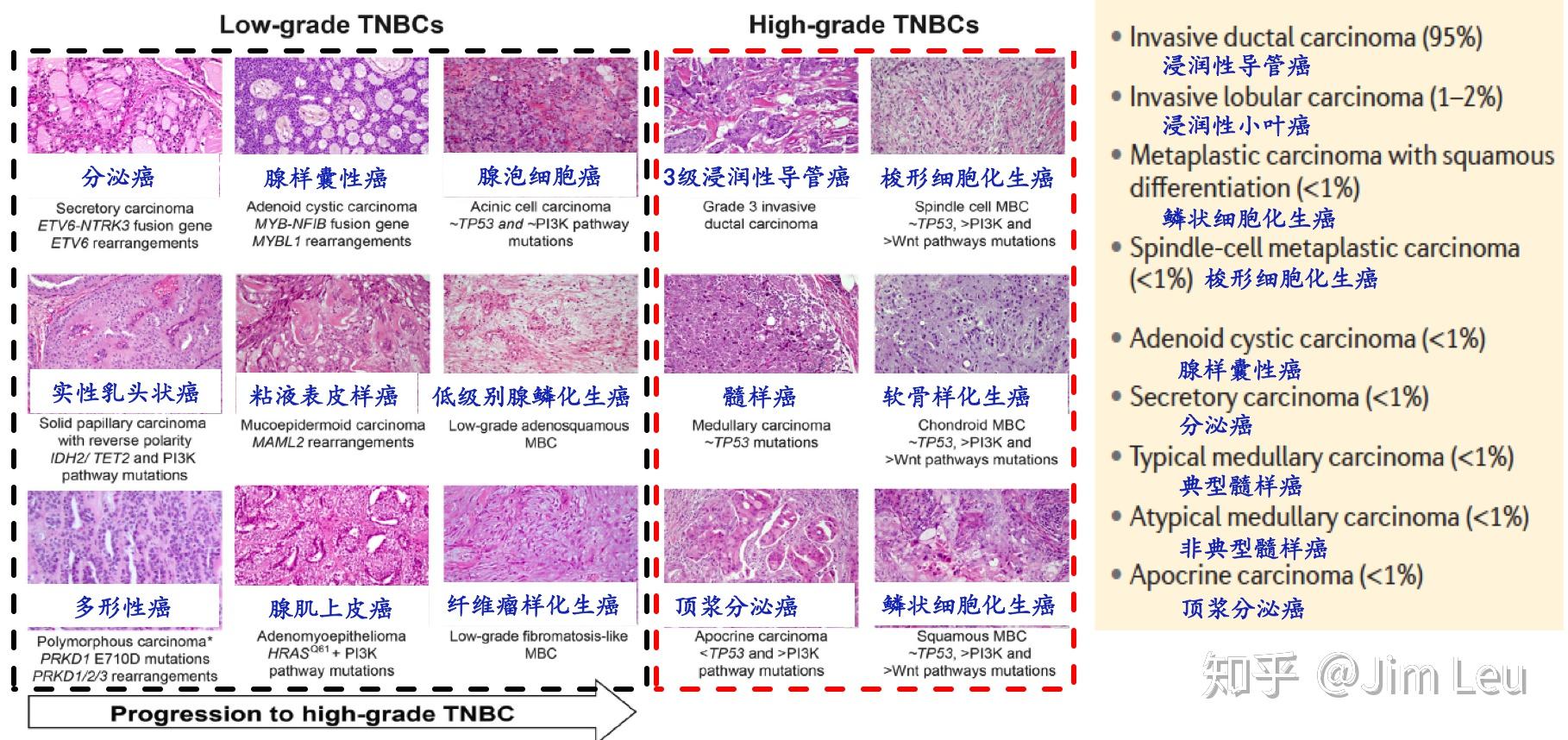 三阴性乳腺癌（TNBC）：一小群横行乡间的捣蛋鬼 - 知乎