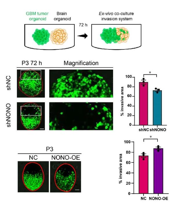 新时代研究模型 | 类器官与慢病毒更配哦！ - 知乎