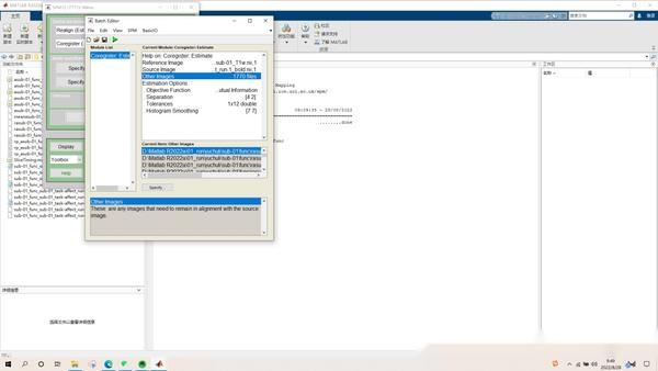 如何用SPM完成fMRI数据的预处理【任务态】 - 知乎
