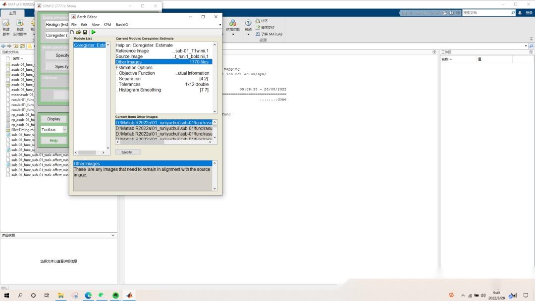 如何用SPM完成fMRI数据的预处理【任务态】 - 知乎