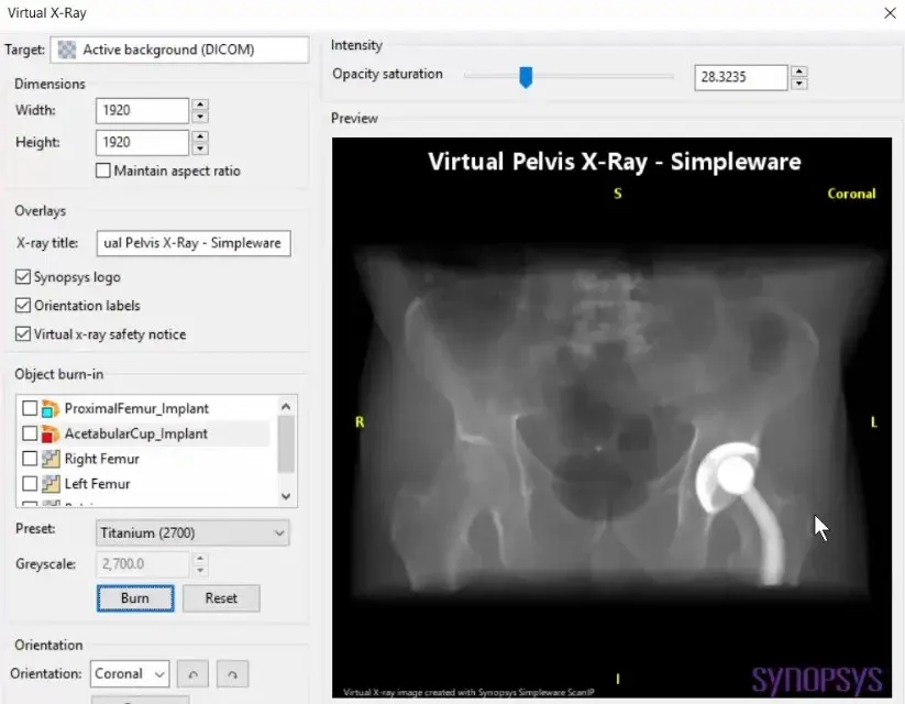【Simpleware 手册】X 射线 - 知乎