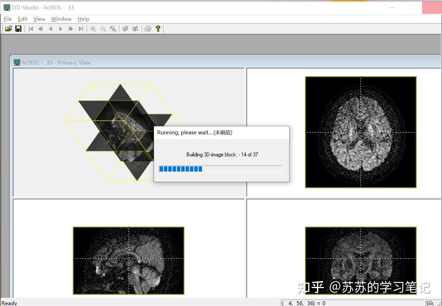 DTI Studio操作教程 - 知乎