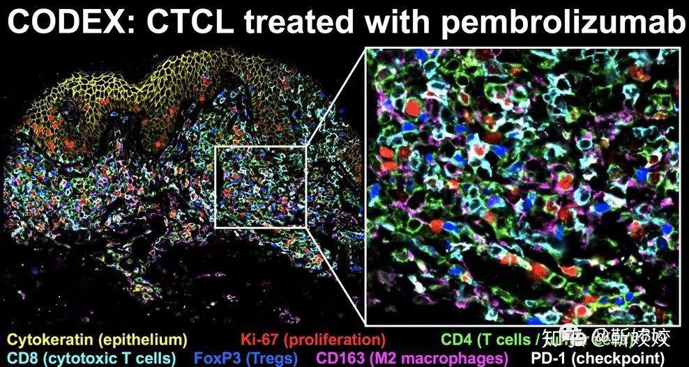 遇见CODEX|一文详解CODEX单细胞空间蛋白组学分析平台技术原理 - 知乎