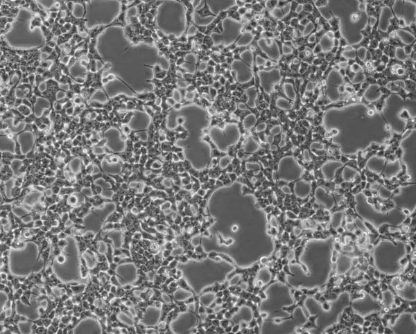 解决方案 | 293T细胞培养攻略 - 知乎