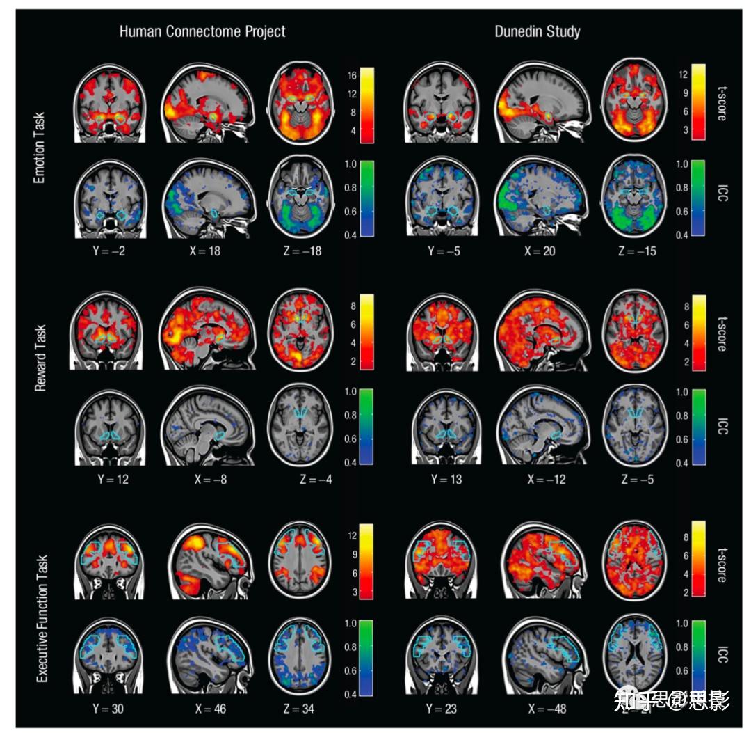 任务态fMRI测量的重测可靠性：新的实证证据和元分析 - 知乎