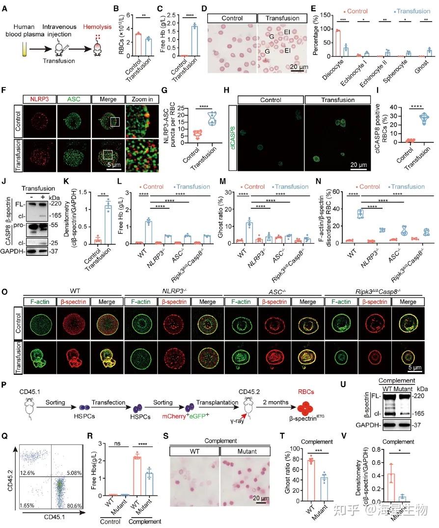 Cell(IF=45.5) HyCyte细胞助力科研—揭示NLRP3炎症小体介导溶血性细胞死亡新机制 - 知乎