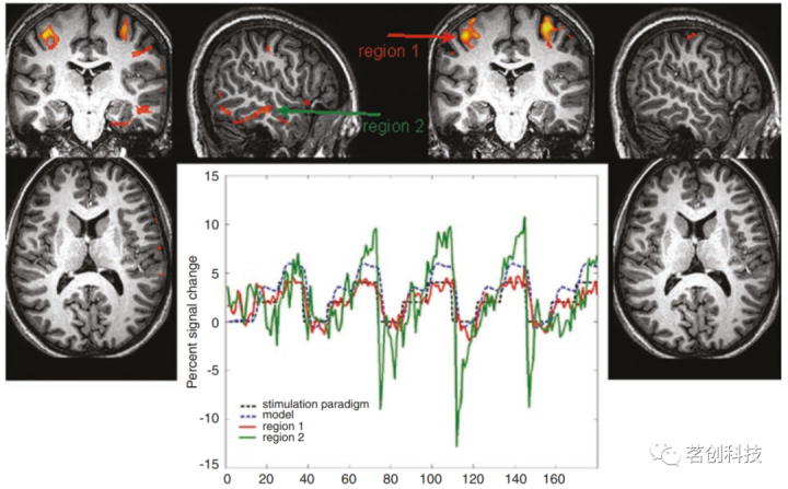 BOLD fMRI和DTI：伪影、技巧和诀窍 - 知乎