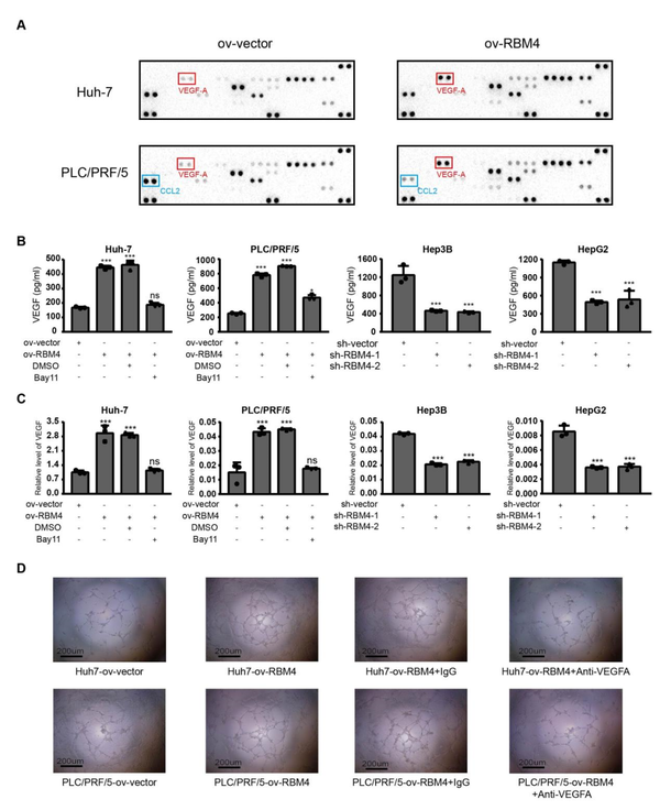 Pharmacol Res | 周国雄/叶军团队研究发现RBM4通过选择性激活VEGF-A的表达来促进肝癌中的血管生成 - 知乎