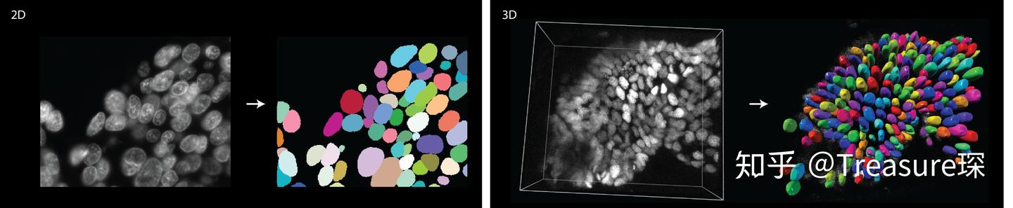 ImageJ实用教程——StarDist批量细胞计数(案例分析篇) - 知乎