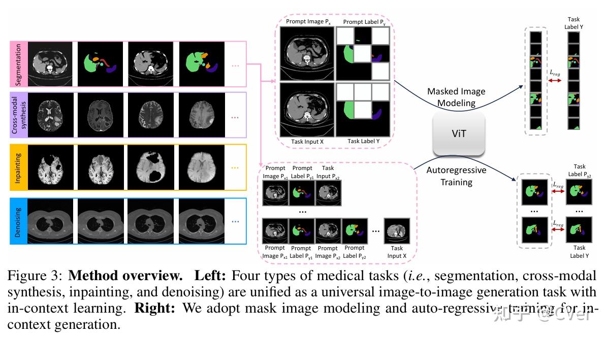 医学视觉通才(MVG)模型：在上下文中统一医学影像任务 - 知乎