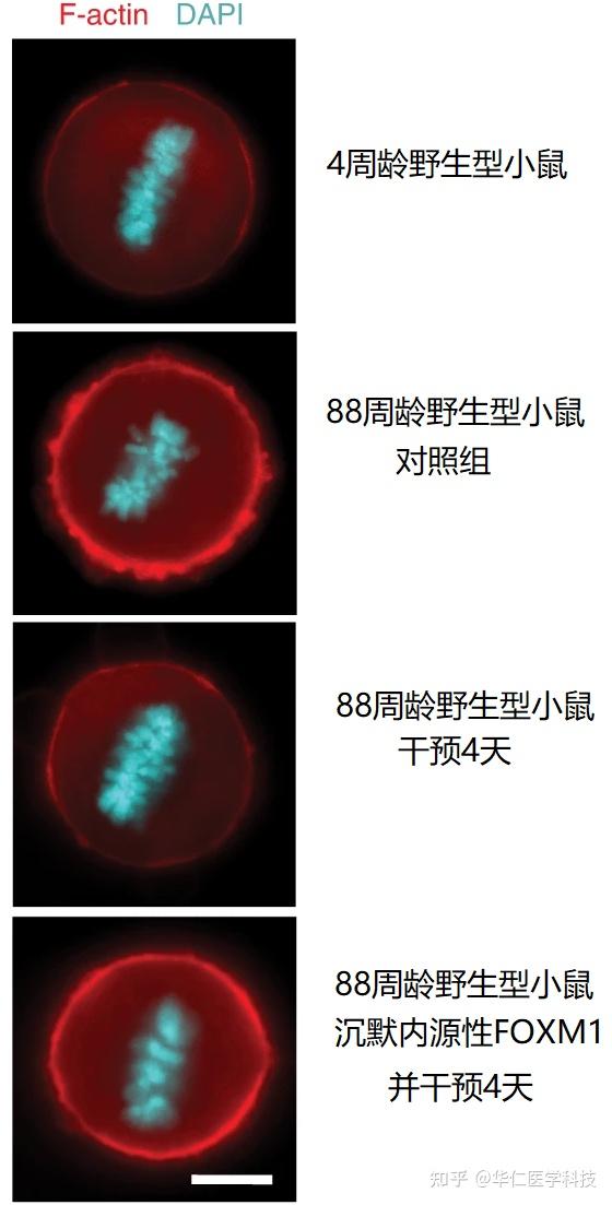 抗衰老研究的新靶点——FOXM1 - 知乎
