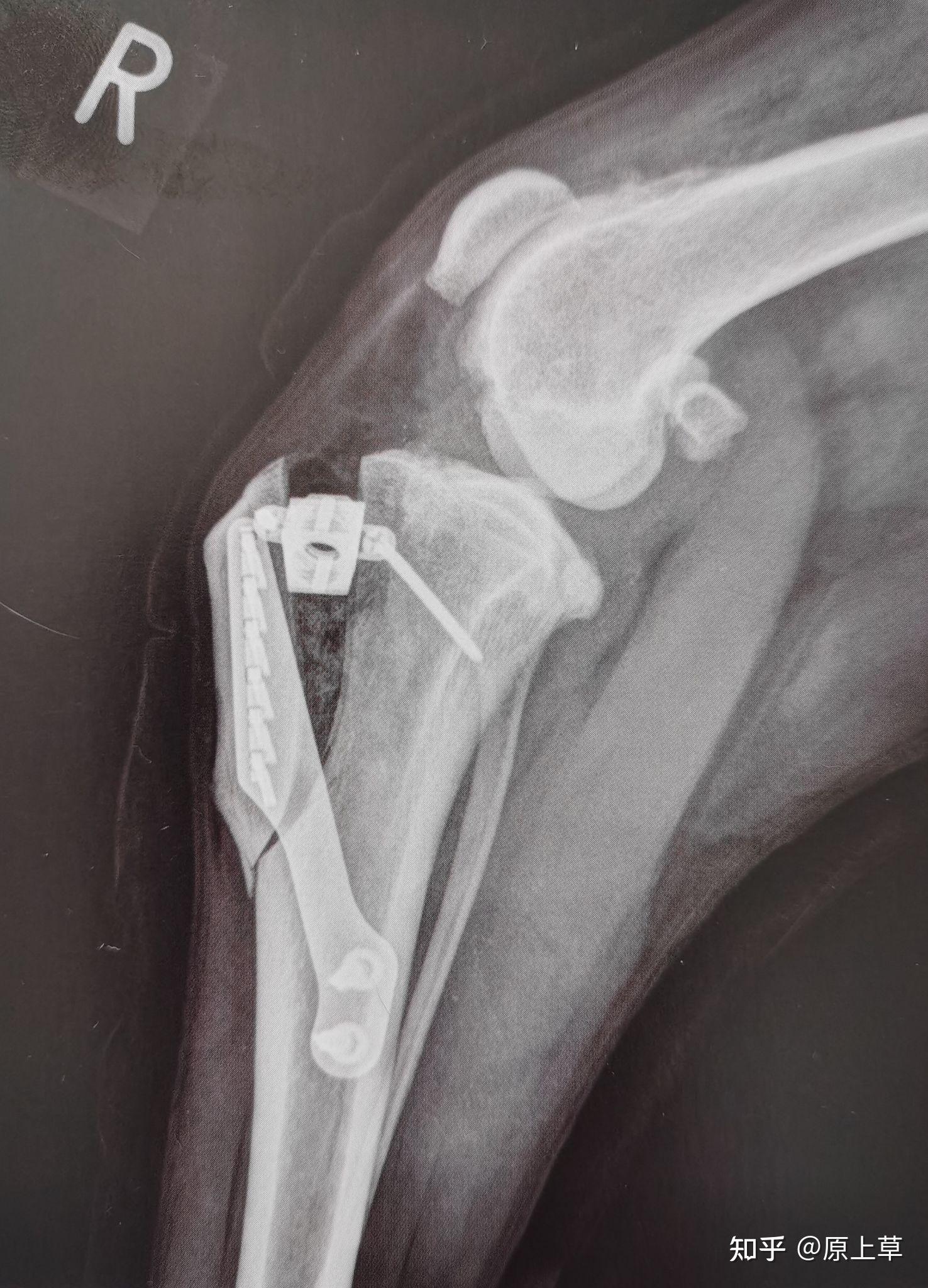 犬十字韧带断裂 - 知乎