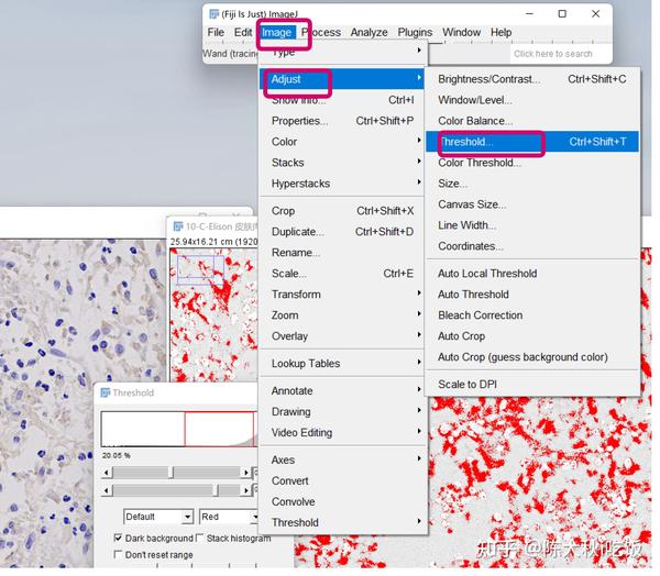 如何使用image j定量免疫组化阳性区域 - 知乎