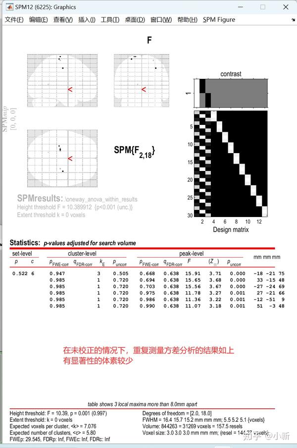 12-SPM-fmri任务态 二阶分析：单因素重复测量方差分析 - 知乎