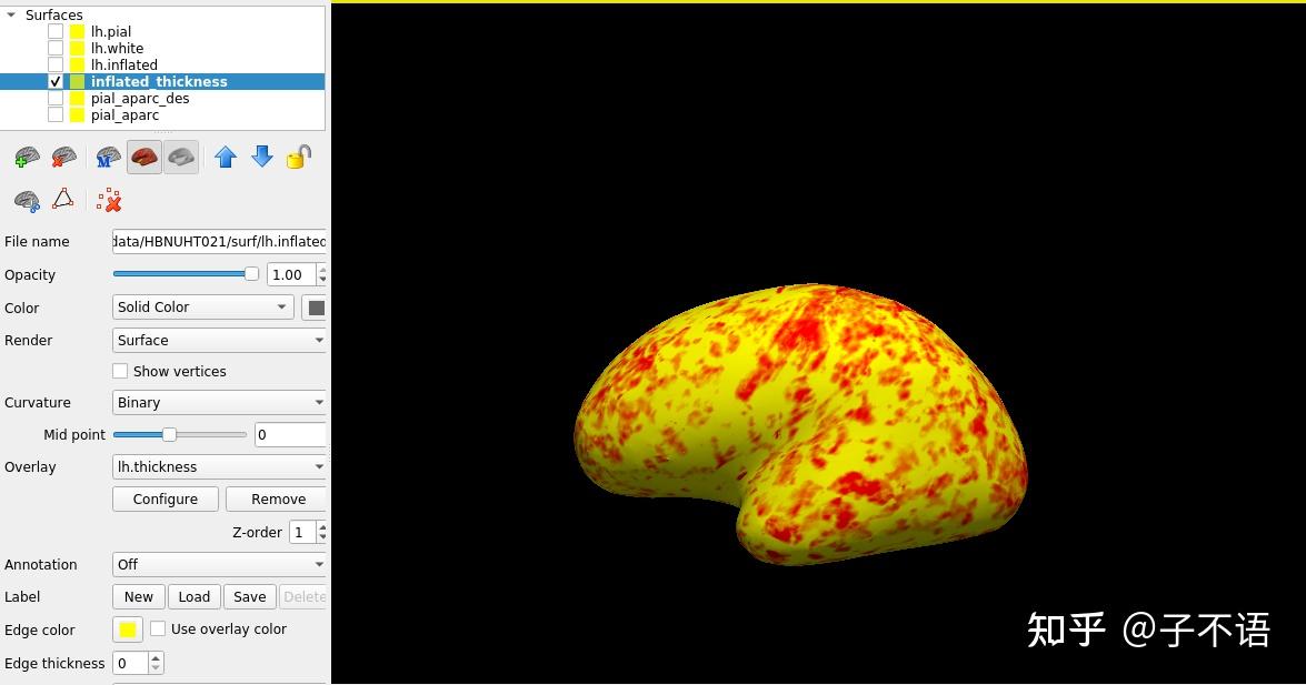 freesurfer全过程梳理 - 知乎