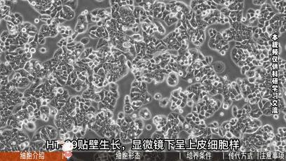 HT-29细胞培养，人结肠癌细胞培养攻略 - 知乎