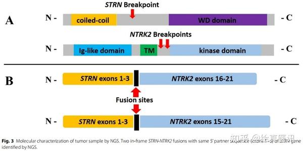 RNA-based NGS在肉瘤中检出罕见双重STRN-NTRK2融合，一线拉罗替尼治疗反应良好 - 知乎
