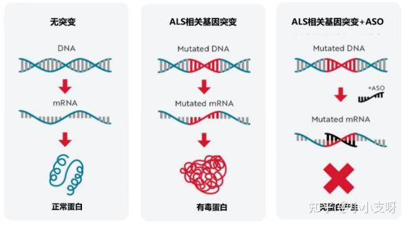 “渐冻症”治疗获重大进展！首款基因疗法Tofersen突破治疗困境 - 知乎
