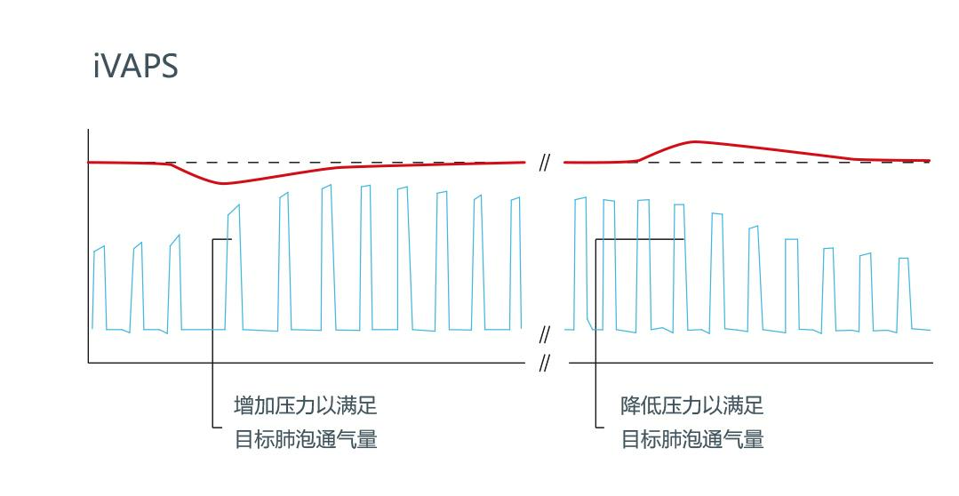 瑞思迈呼吸机IVAPS模式与传统ST模式有什么区别？ - 知乎