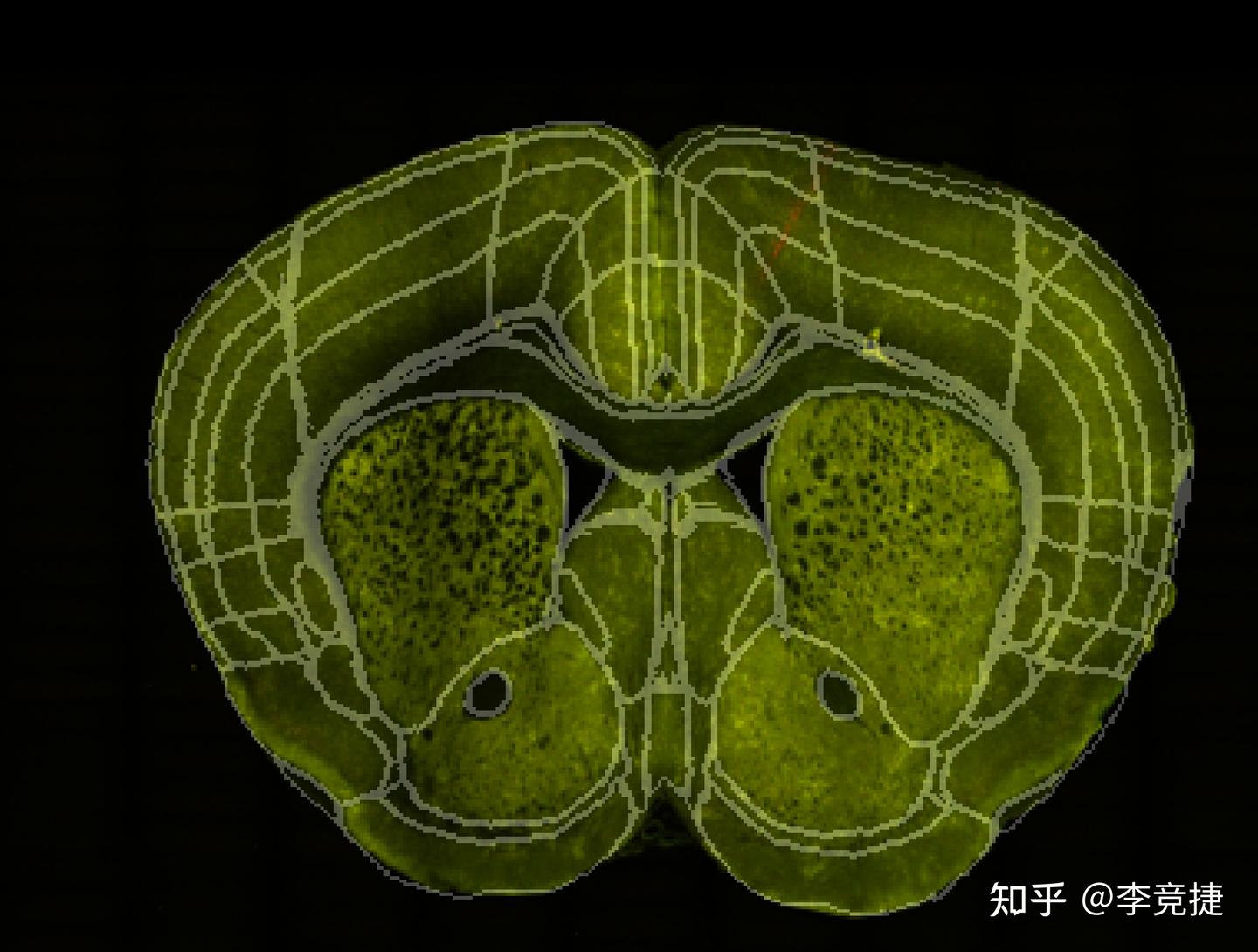 大规模神经记录后的全脑重建 - 知乎