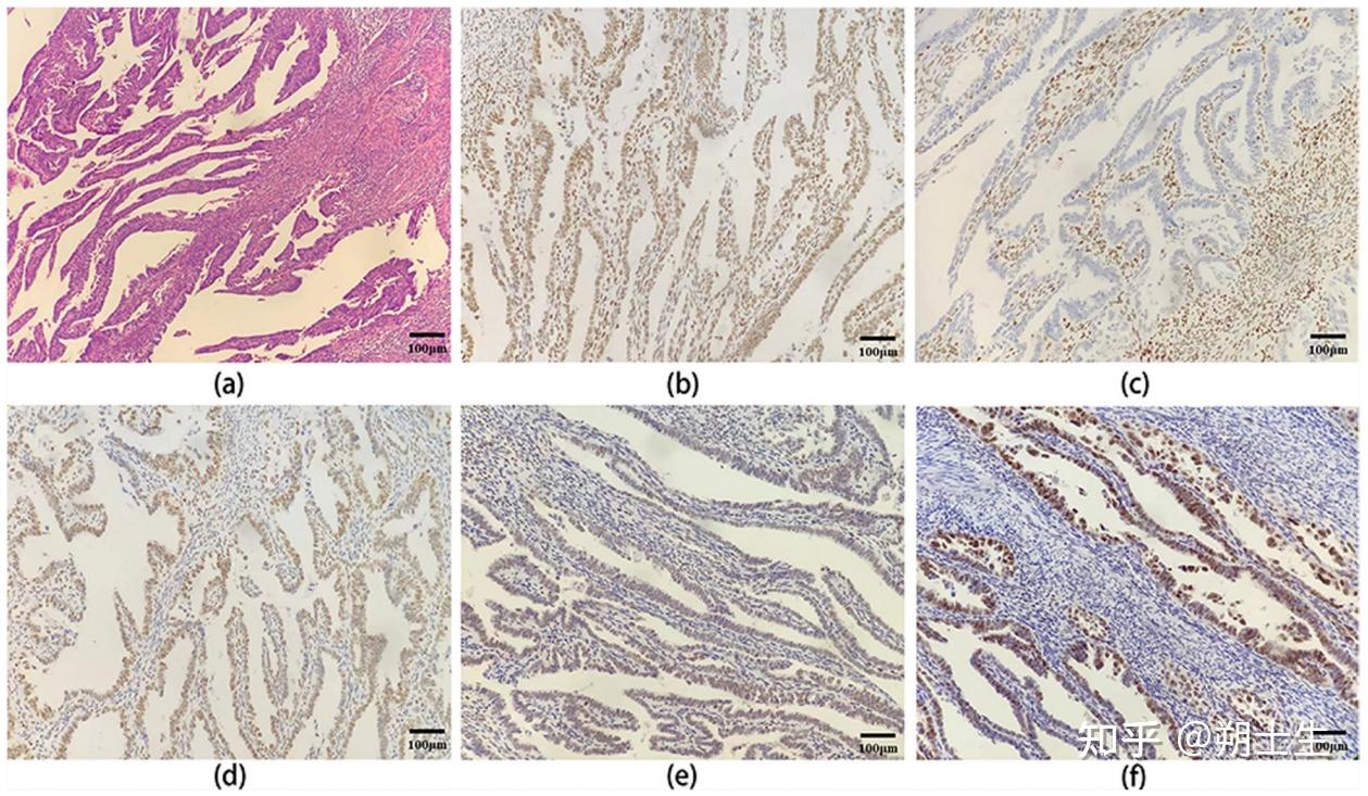 再谈POLE/POLD1 - 知乎