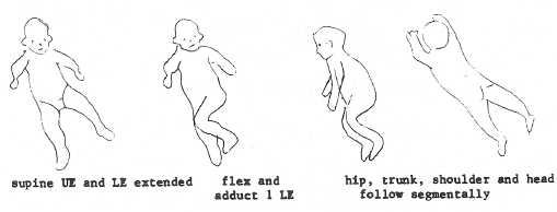 儿康笔记——立直反射检查 - 知乎
