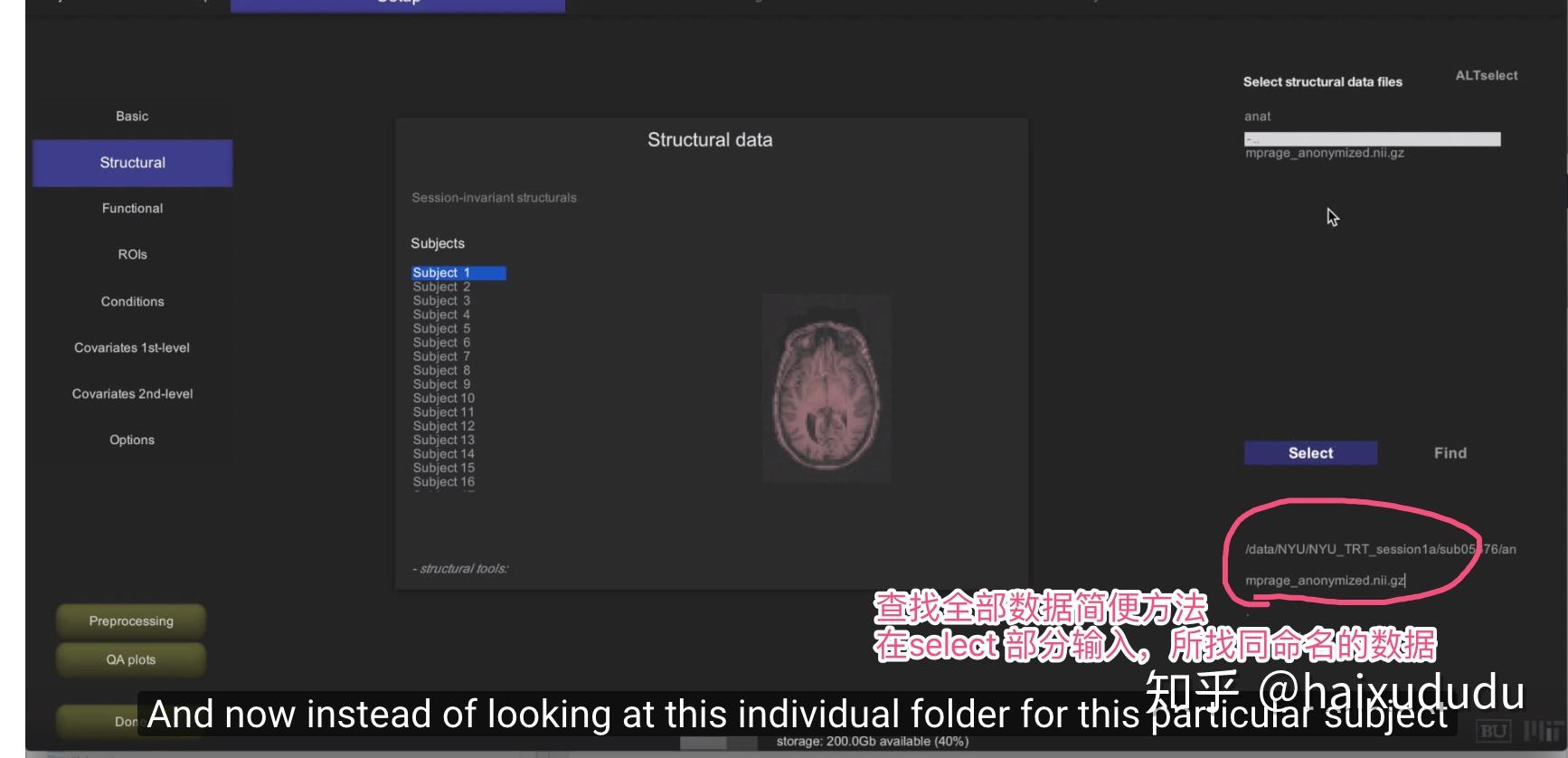 CONN使用总结1 (resting-state fMRI) - 知乎