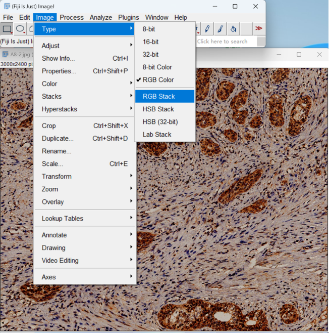 解忧小工具｜保姆式教程！用Image J进行免疫组化分析（IHC score评分） - 知乎