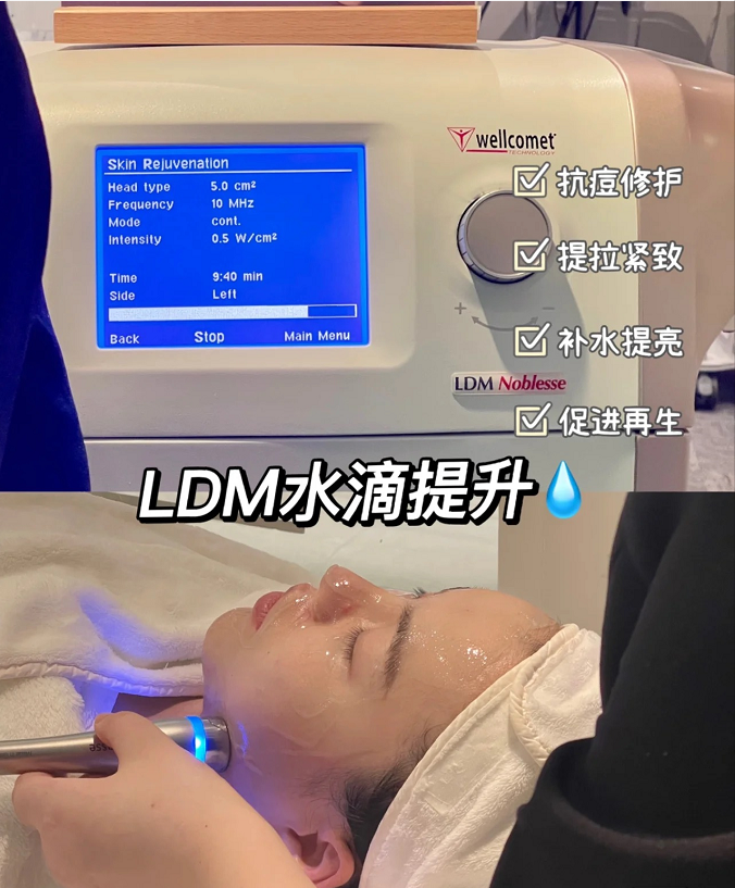 抗老绝绝子韩国HIFU热提拉联合LDM水滴提升 - 知乎