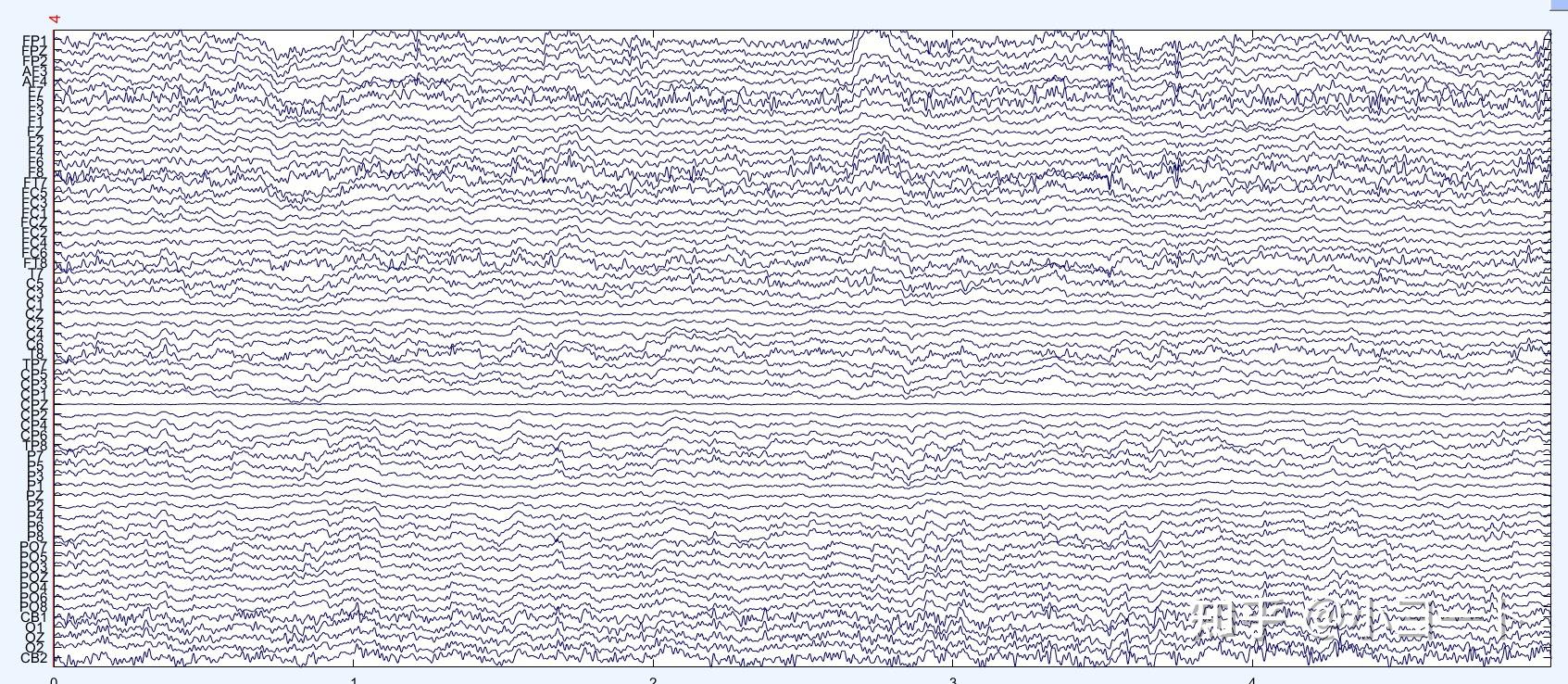 手把手系列教程||使用EEGLAB2023版对脑电数据进行预处理 - 知乎