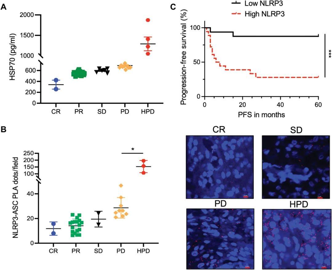 STM | 瘤内NLRP3-HSP70-TLR4轴在抗PD-1治疗期间驱动转移前生态位/肿瘤超进展 - 知乎