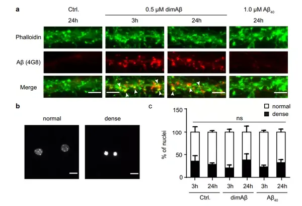 Nat Commun：内溶酶体的Aβ浓度和pH值触发Aβ寡聚体的形成，诱导Tau错配 - 知乎