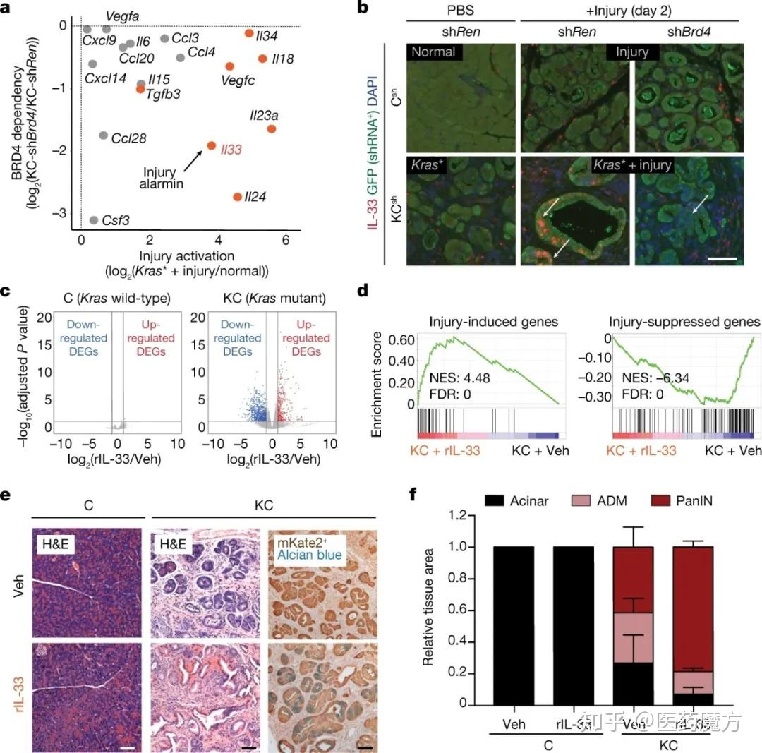 胰腺癌是如何形成的？Nature揭秘：KRAS突变和组织损伤，缺一不可！ - 知乎