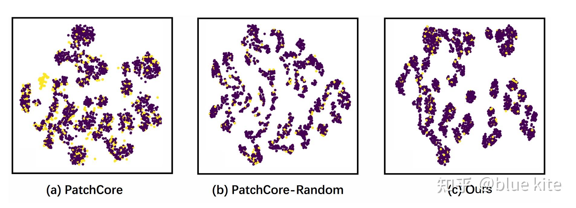 【异常检测】SoftPatch: Unsupervised Anomaly Detection with Noisy Data - 知乎