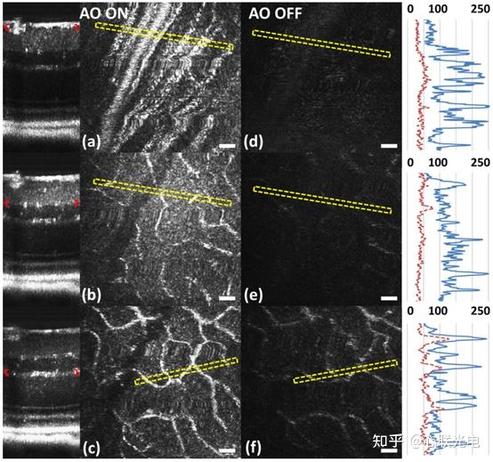 J BIOMED OPT：用于小鼠视网膜体内成像的自适应光学OCT - 知乎