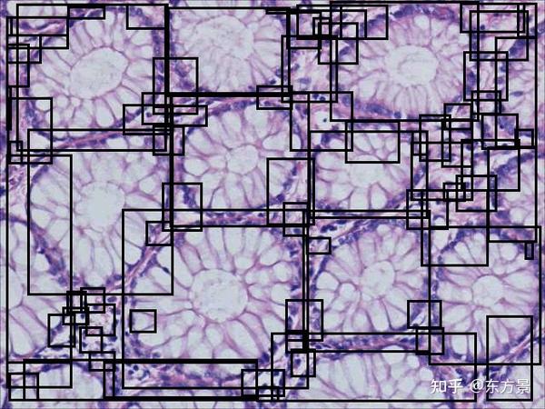 ImageJ | 免疫组织化学（IHC）图像分析工具箱 | 下载地址 | 安装教程 | 使用教程 - 知乎