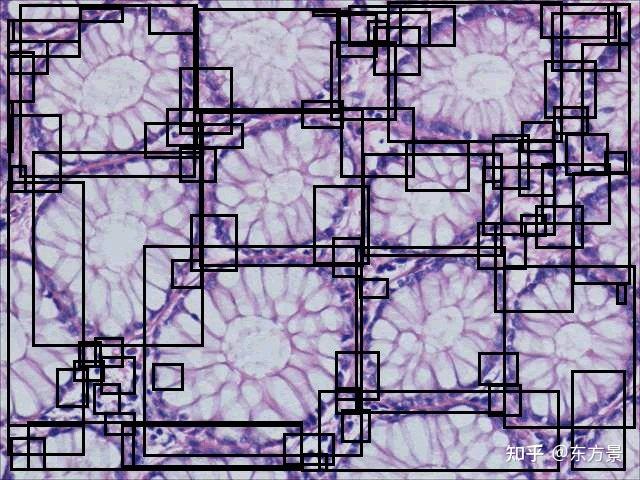 ImageJ | 免疫组织化学（IHC）图像分析工具箱 | 下载地址 | 安装教程 | 使用教程 - 知乎
