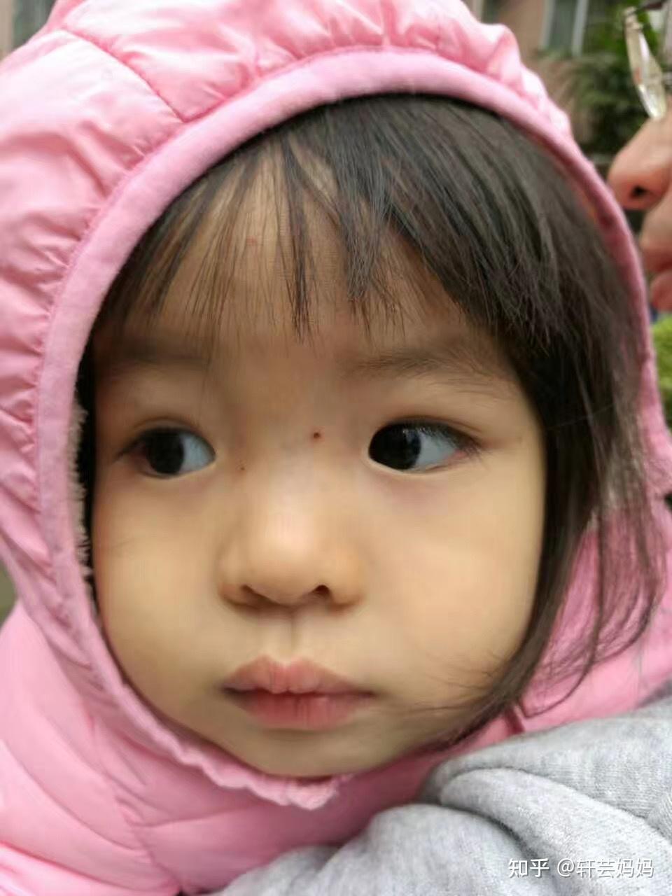 1 岁宝宝被家人狂亲，出现高烧不退等症状，感染 EB 病毒，什么是 EB 病毒？有哪些行为家长应避免？ - 知乎