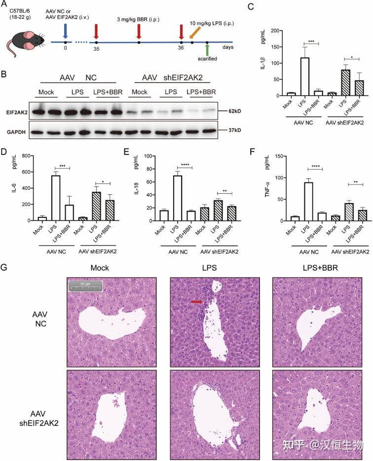 IF>14|揭秘小檗碱BBR抗炎作用新靶标—EIF2AK2 - 知乎