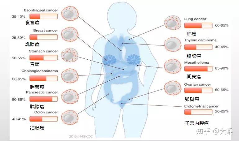 靶向间皮素（MSLN)靶点的CAR-T细胞治疗简介 - 知乎