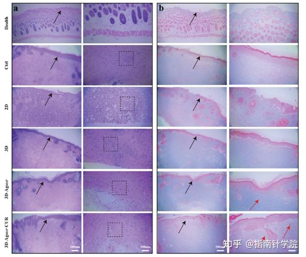Chemical Engineering Journal: 具有原位生长的银金属有机框架的三维层状纳米纤维海绵用于促进伤口愈合 - 知乎
