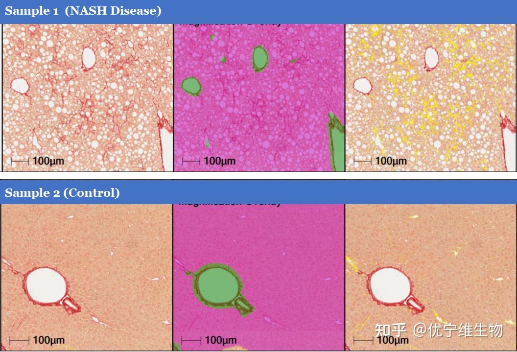 HALO在NAFLD/NASH小鼠模型组织病理学的定量评估 - 知乎