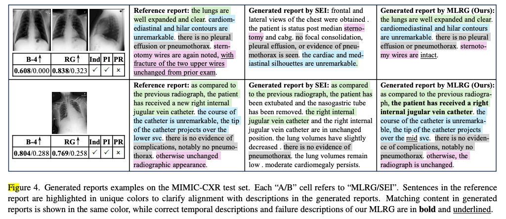 CVPR 2025 | MLRG - 基于多视角纵向数据的增强对比学习用于胸部 X 光报告生成 - 知乎