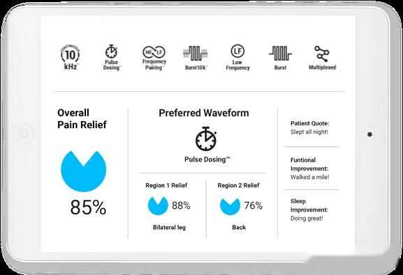 Nevro脊髓刺激系统获批FDA - 知乎