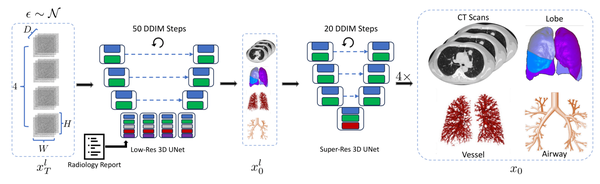 医学生成模型MedSyn：文字引导，AI“画”出高保真CT图像 - 知乎