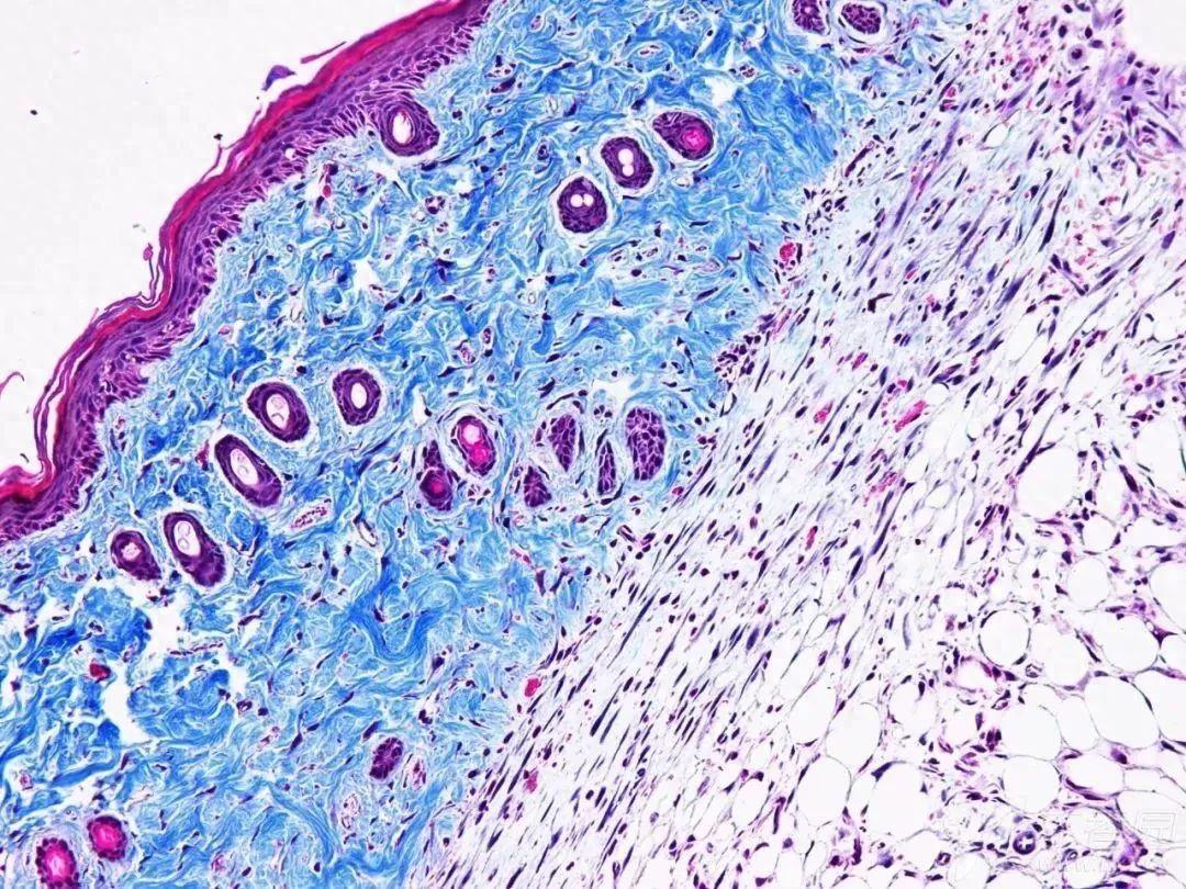 深入探秘Masson三色染色：解析实验原理、步骤与注意事项！ - 知乎