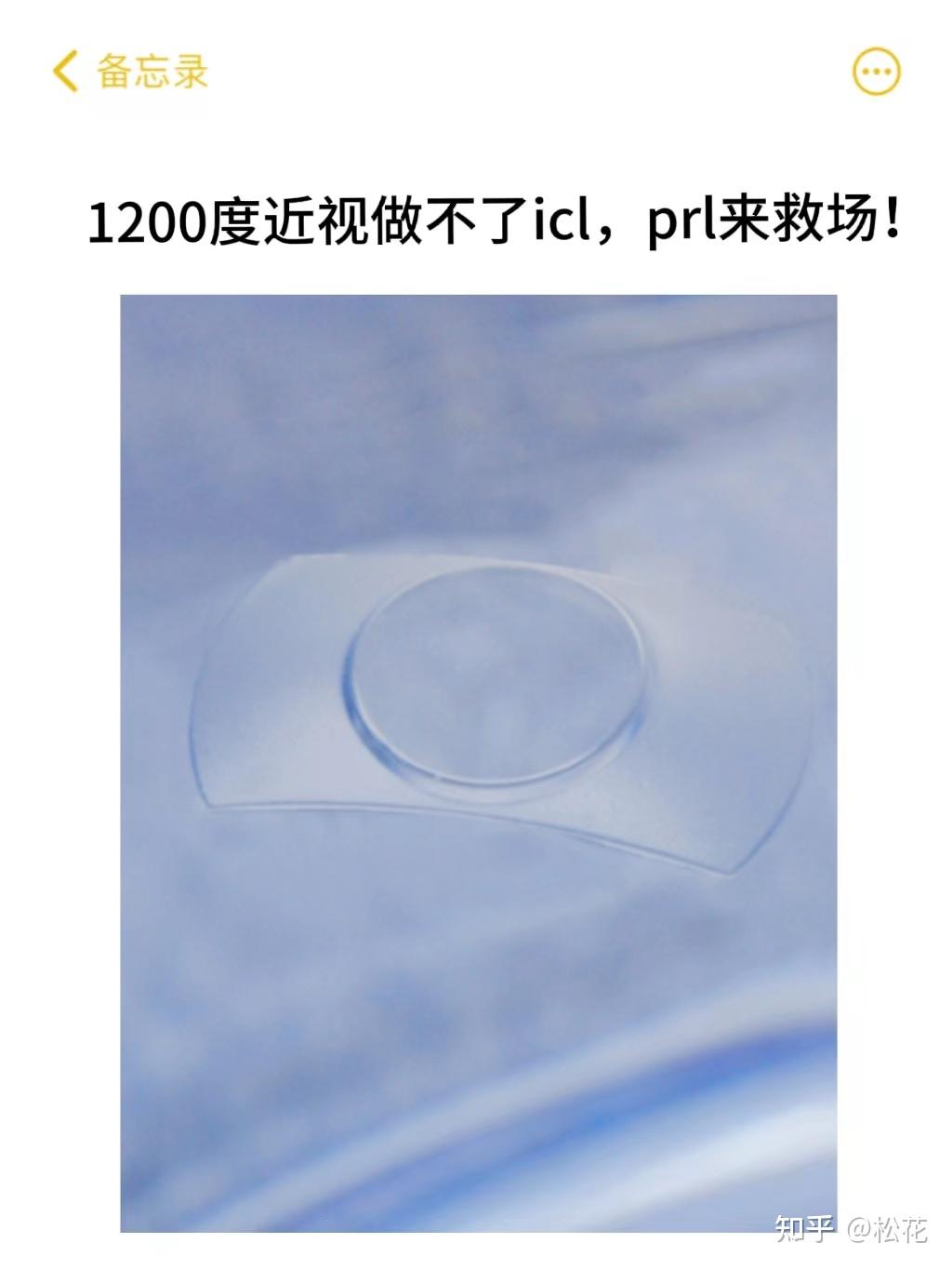 近视1200度做不了ICL，PRL晶体植入术来解忧！ - 知乎