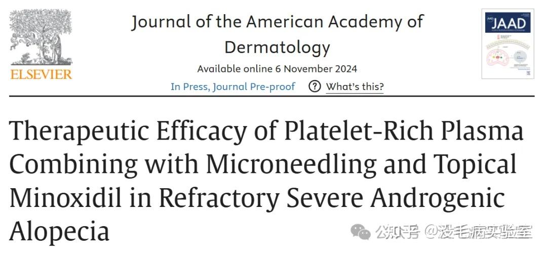 美国皮肤病学会JAAD：PRP+微针+米诺地尔攻克重度难治性脱发！ - 知乎