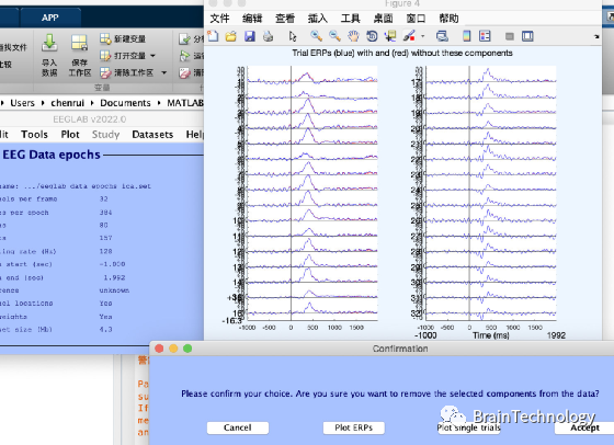 EEGLAB系列教程5：数据预处理2（ICA去伪迹） - 知乎